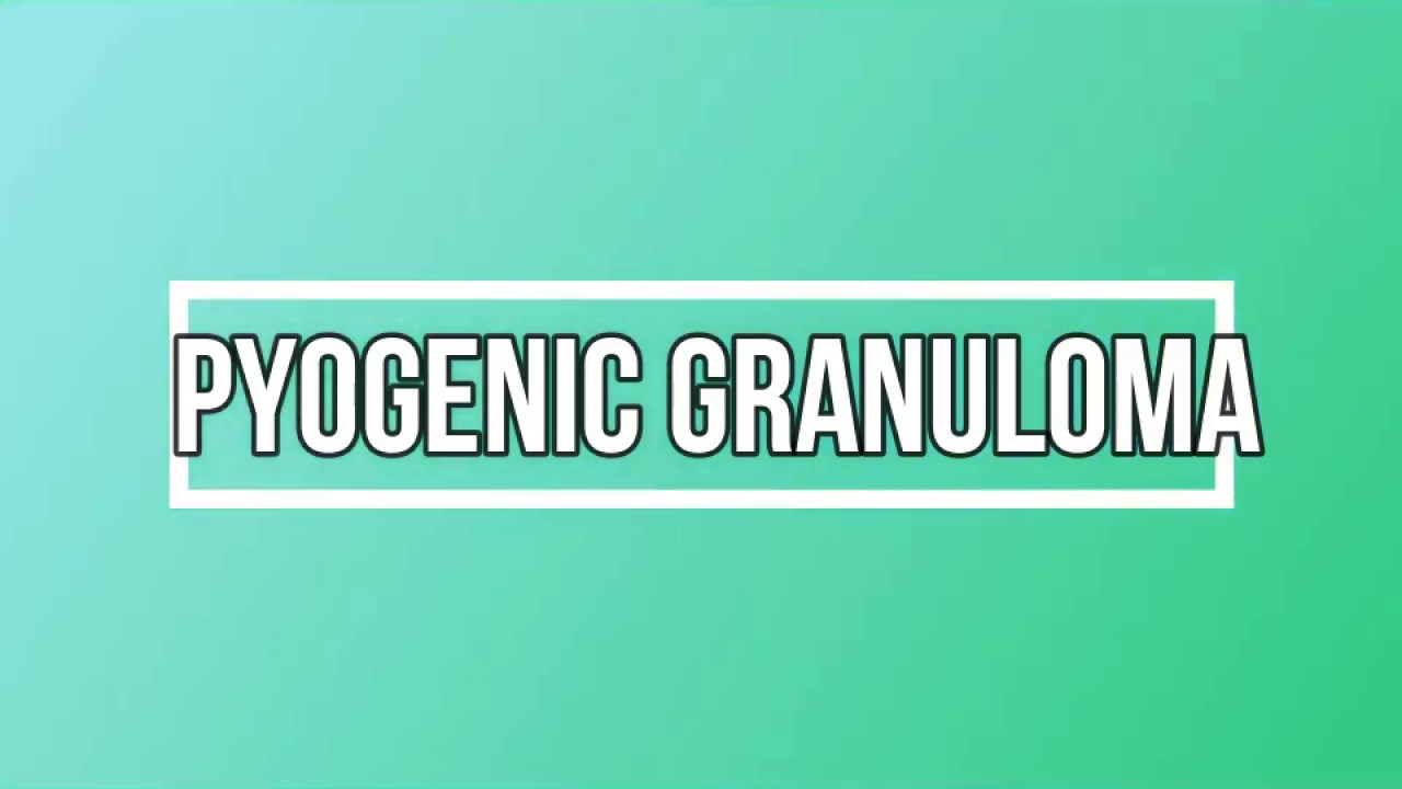 Pyogenic Granuloma: History, Clinical and histological features ...