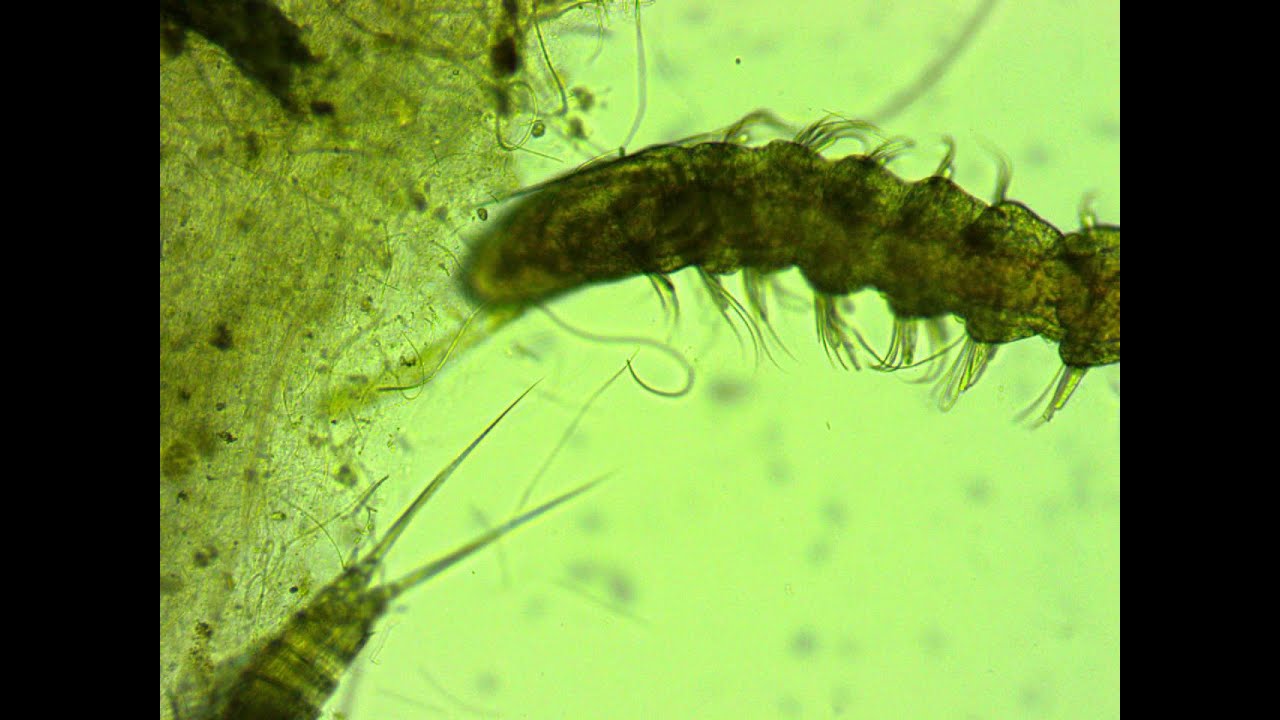 white stringy bacteria 5 - YouTube