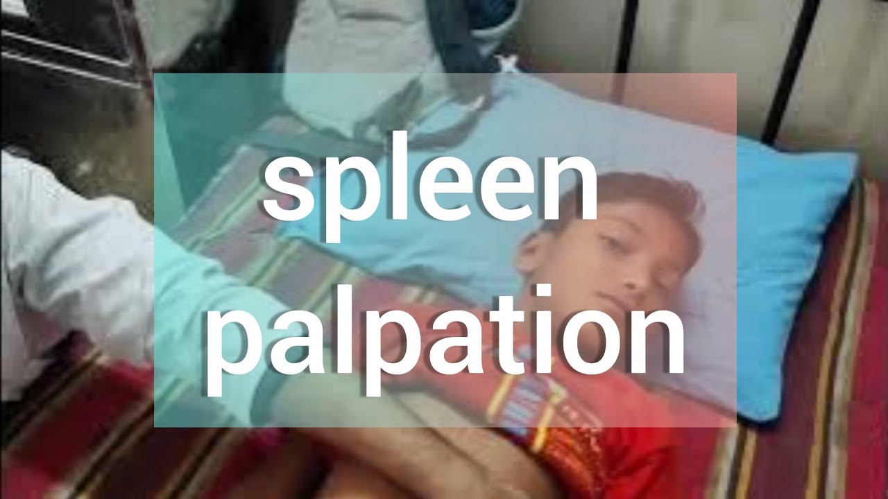 spleen palpation | palapation of the spleen | clinical examination ...