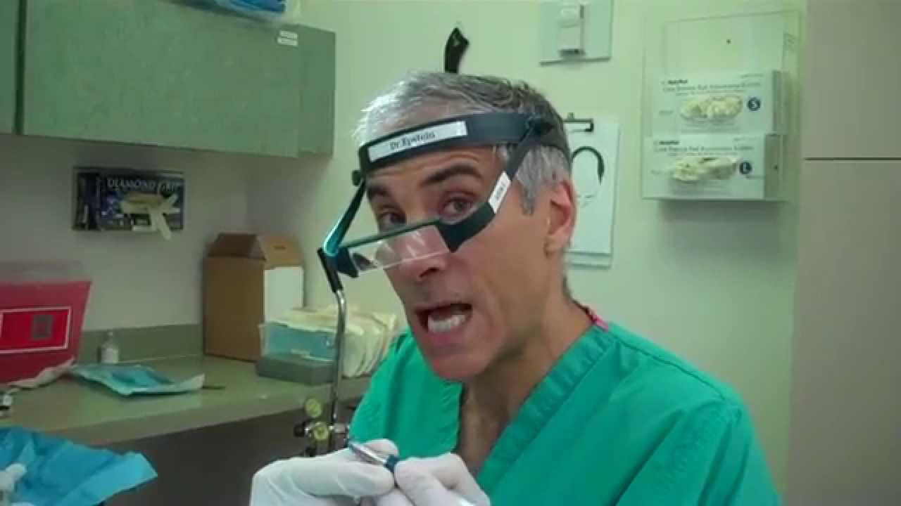 Dr. Jeffrey Epstein - Performing FUE Procedure - YouTube