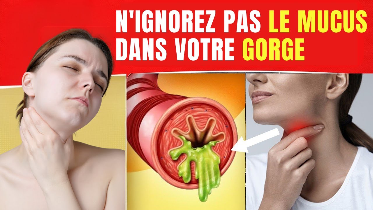 Comment éliminer l’excès de mucus dans la gorge ? - YouTube
