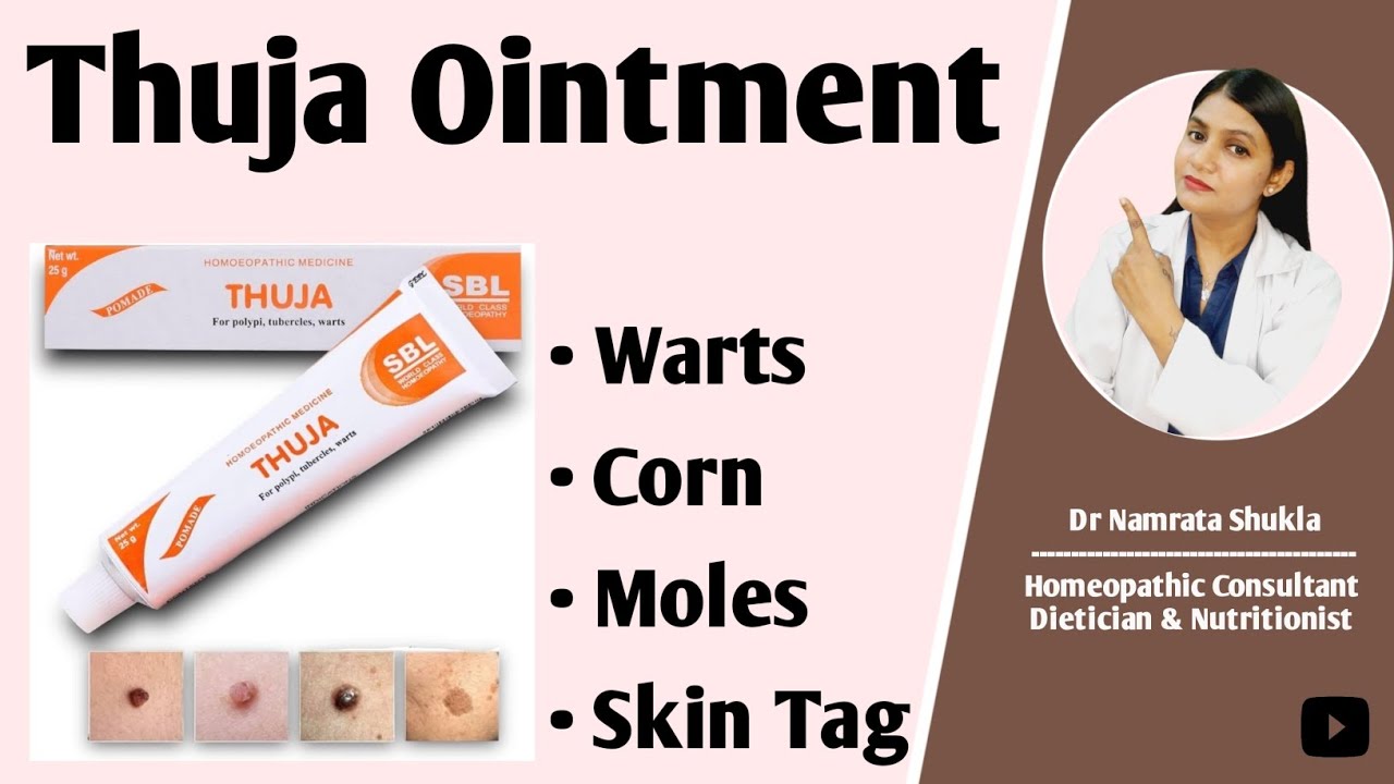 Thuja ointment for warts removal | thuja cream ke fayde - YouTube