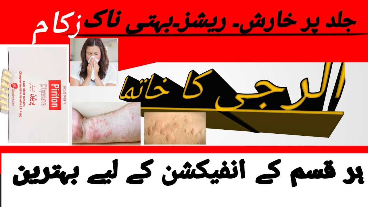 PIRITON TABLET | Uses | Side Effects | Allergy Infection Skin Rashes ...