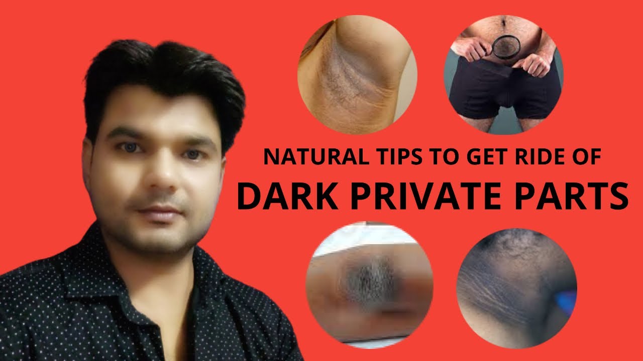 HOW TO GET RID OF DARK PRIVATE PARTS I LIGHTEN YOUR DARK UNDERARMS NATURALLY YouTube how-to-get-rid-of-dark-private-parts-i-lighten-your-dark-underarms-naturally-youtube