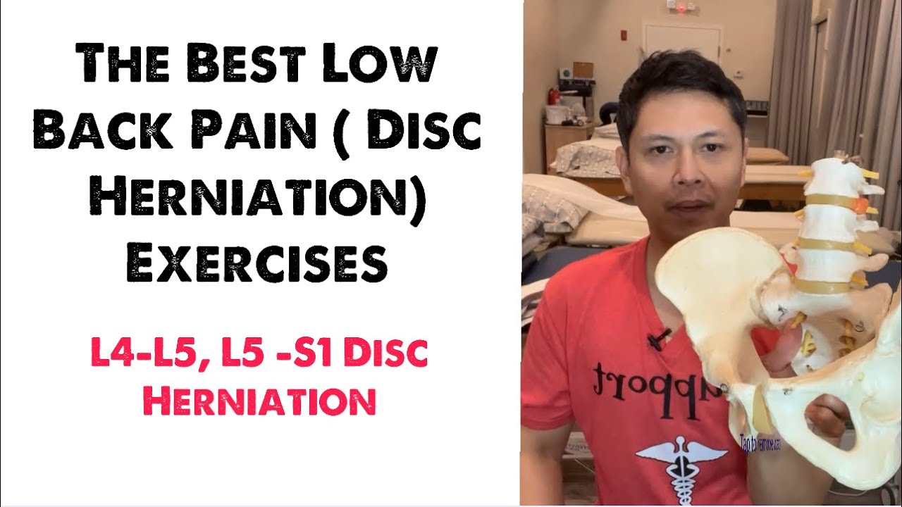 Best Exercises for Low Back Pain (Disc Herniation) by Doc Jun - YouTube