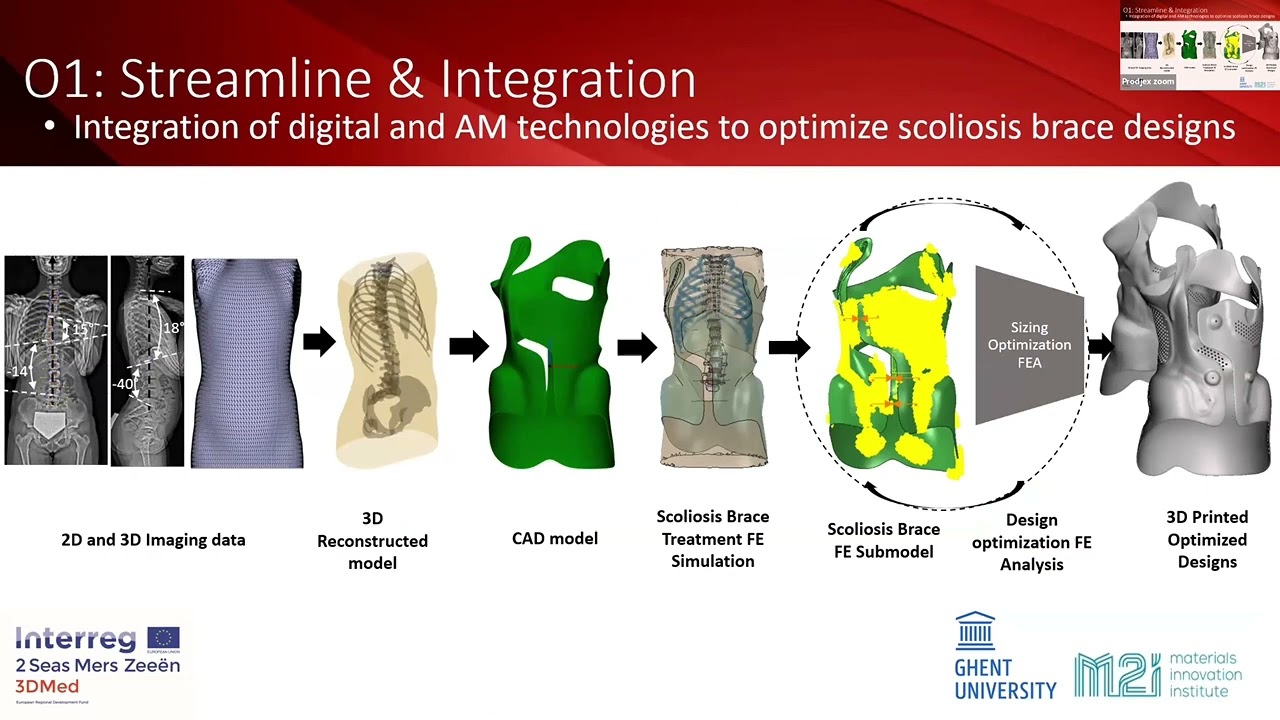 Rational design for 3D printable spinal orthoses - YouTube