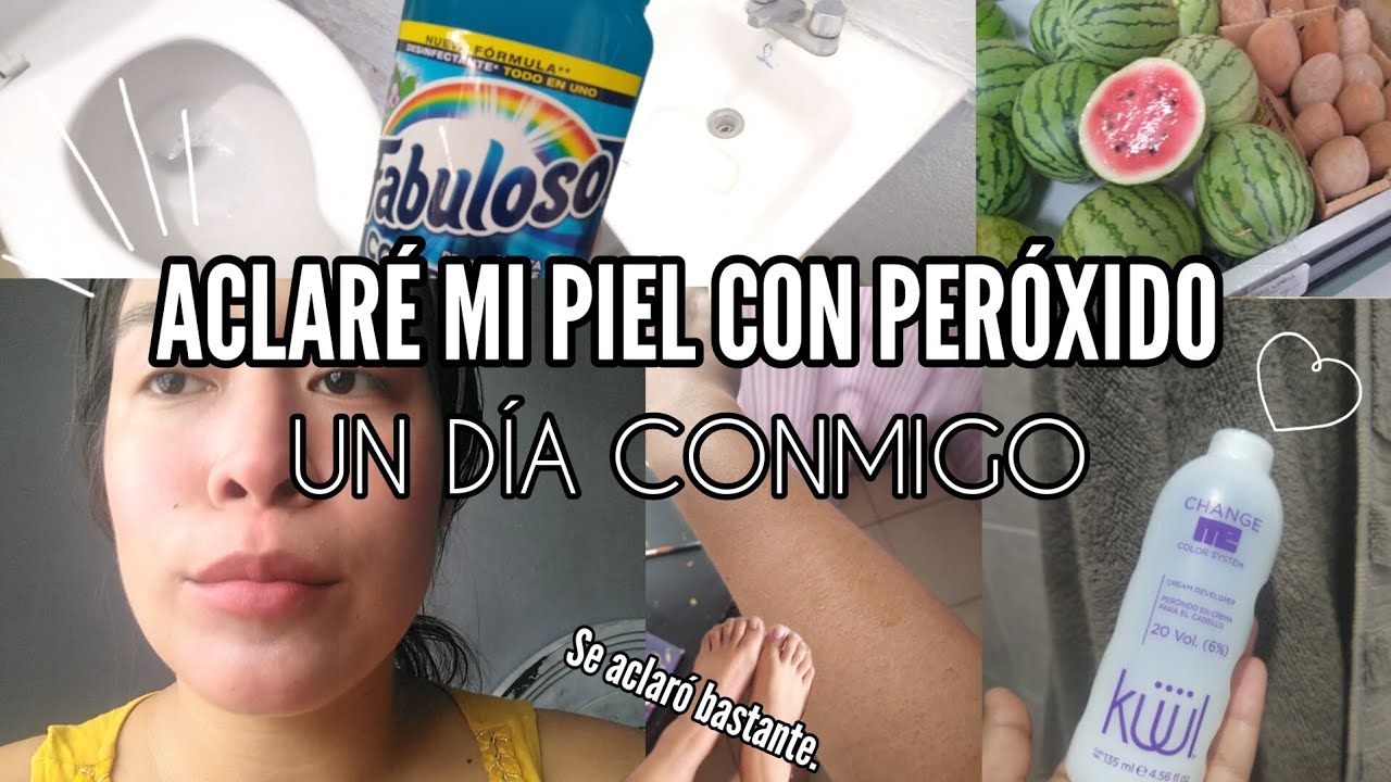 Cómo aclaré mi PIEL con PEROXIDO. Rostro y Cuerpo VIDEOBLOGS # ...