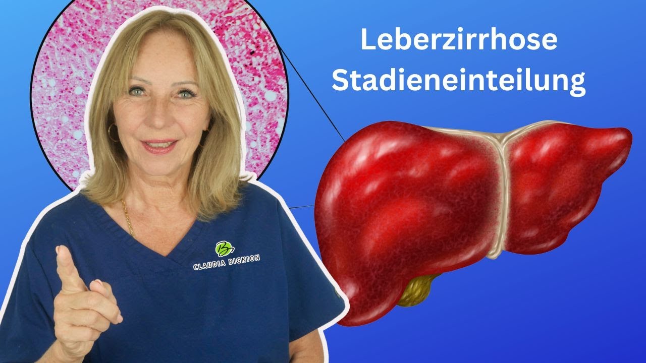 Leberzirrhose bis zum Endstadium | Dr. Claudia Bignion - YouTube