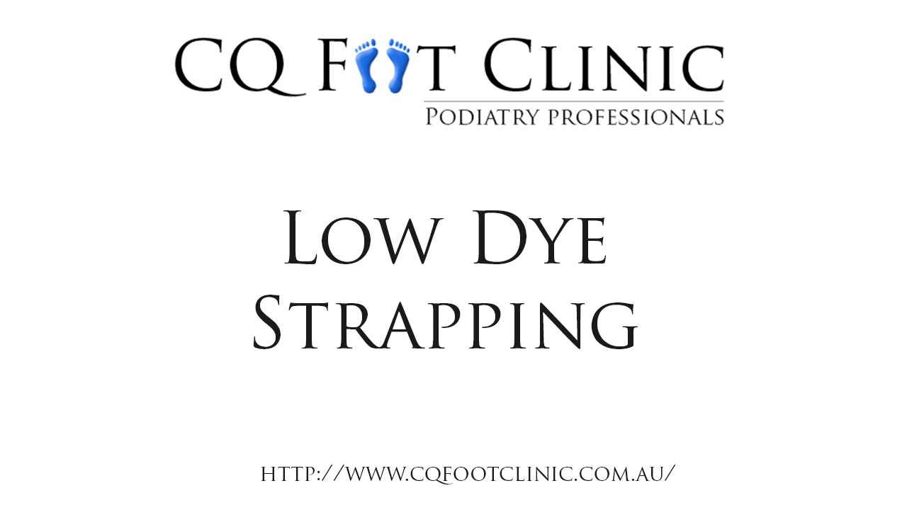 Low Dye Strapping - YouTube