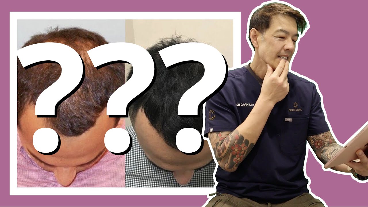 Guessing The Treatment From Just Before And After Photos Dr Davin Lim 8613