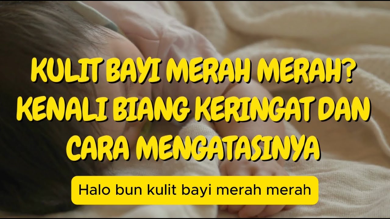 🔥Kulit Bayi Merah-Merah? Kenali Biang Keringat & Solusinya - YouTube