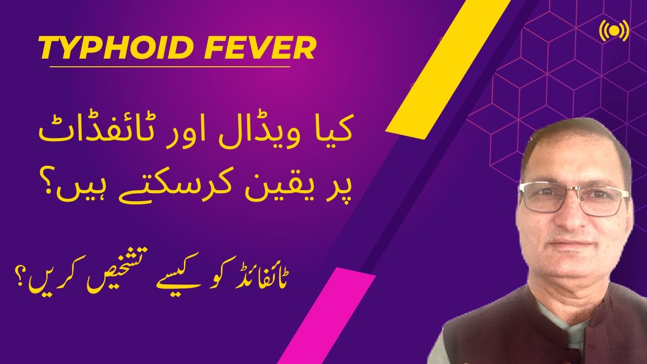 Typhoid fever | Diagnosis and treatment | serological tests | Dr Imdad ...