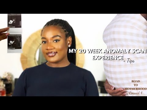 ANOMALY SCAN || ANATOMY SCAN || 20 WEEK PREGNANCY ULTRASOUND || FIRST ...