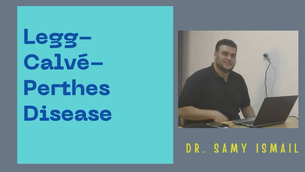 Perthes Disease; Dr Samy Ismail. Qena General Hospital Ortho Scientific ...