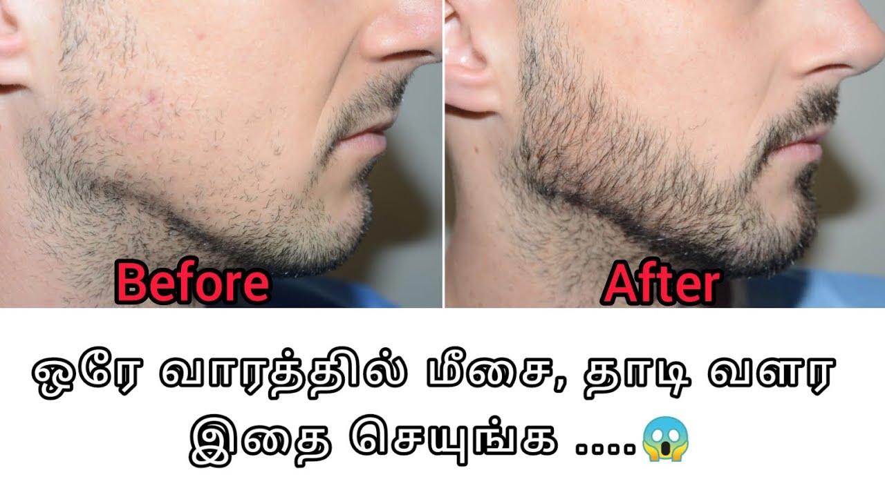 How to grow a Beard Faster Naturally | Tips in tamil | RiyAz- Health ...