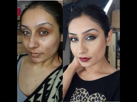Acne scaring rosacea Foundation routine Indian Olive skin tone|| Raji Osahn