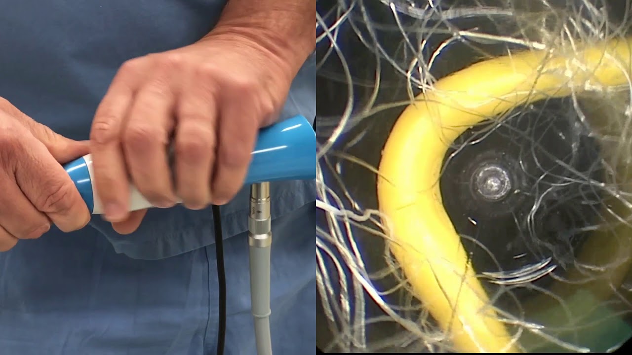 Slow Motion Hand Position Split Screen - YouTube