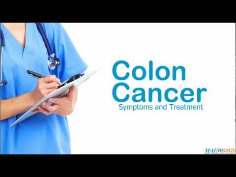 Colon Cancer ¦ Treatment and Symptoms - YouTube