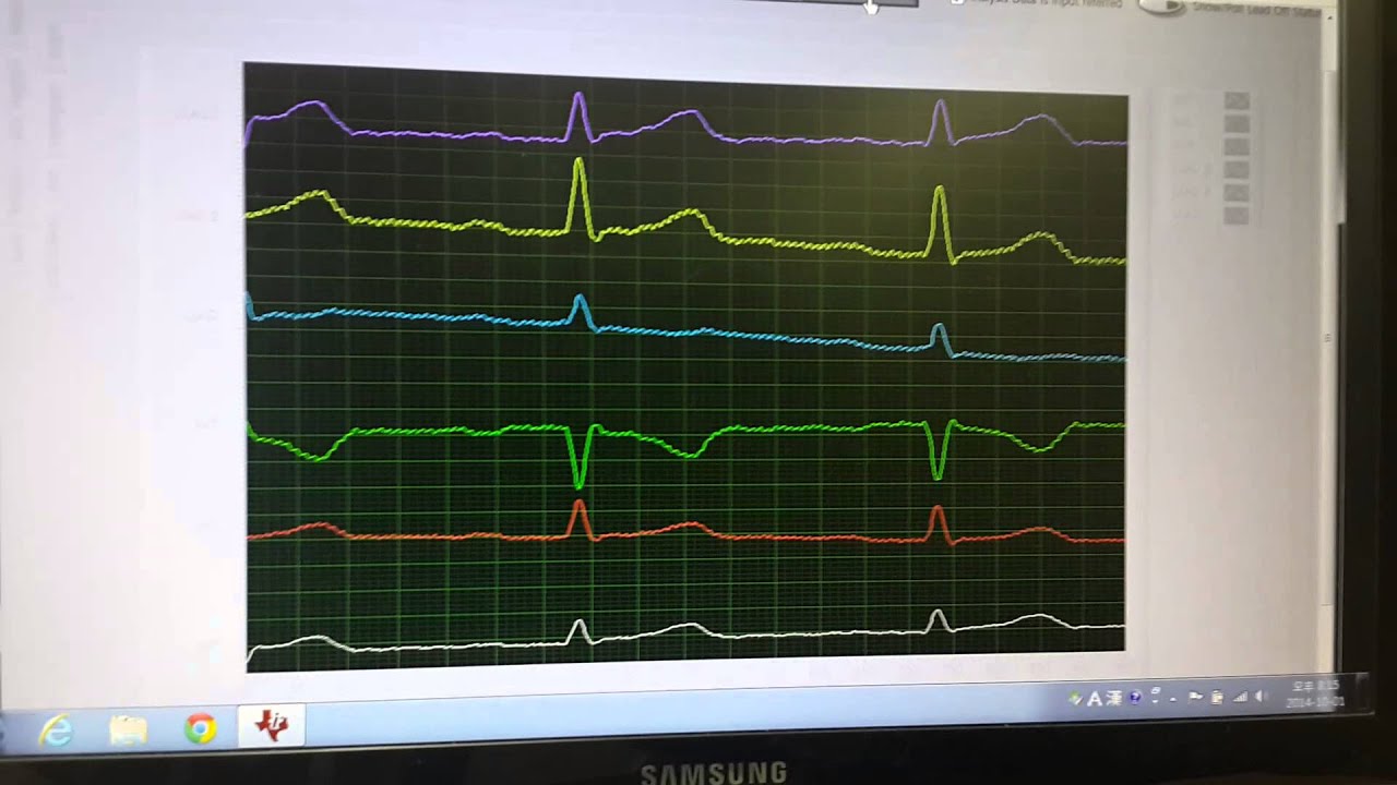 ECG using ADS1298ECGFE-PDK - YouTube