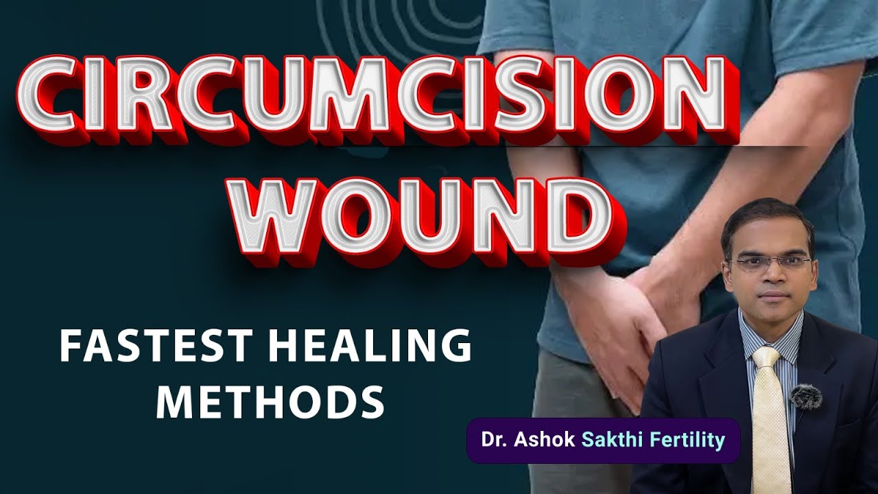 Fastest Healing Tips for Circumcision Wounds | Expert Care & Recovery ...