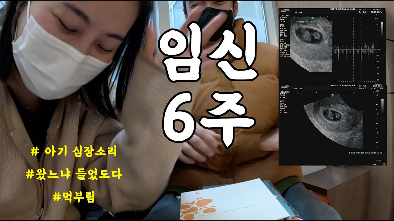 일상 Vlog 임신 6주 👶 아기 심장소리 ️ 임신브이로그 임산부브이로그 💑 부부브이로그 우리 토리 초음파로
