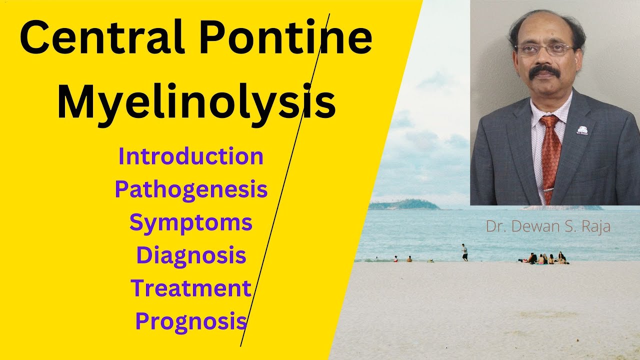 Central Pontine Myelinolysis - YouTube