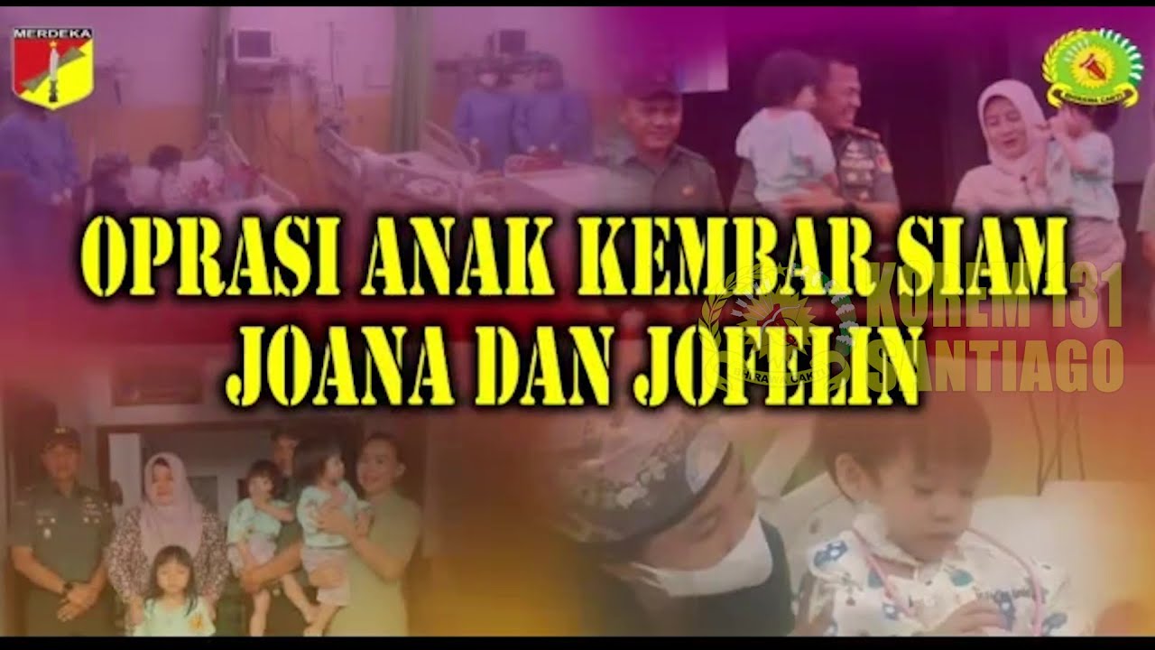 OPERASI ANAK KEMBAR SIAM JOANA DAN JOFELIN PUTRI ANGGOTA KODIM 1302 ...