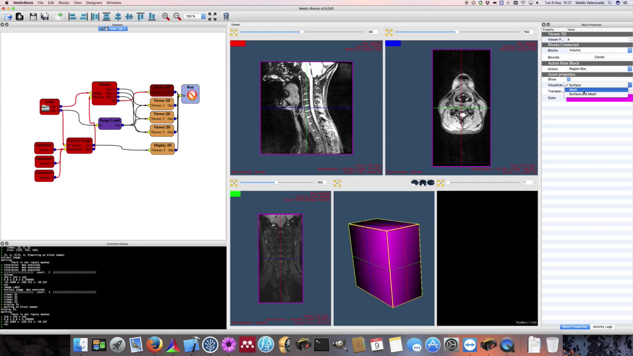 Medic-Blocks (v0.5.0.61) - Extract image and information - YouTube