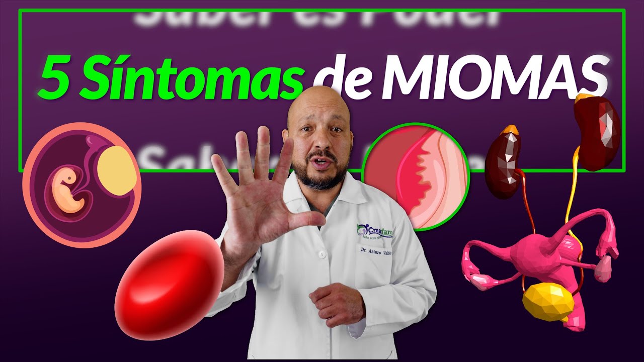 5 Síntomas de Miomas y qué significan [Sangrados, Abultamiento ...