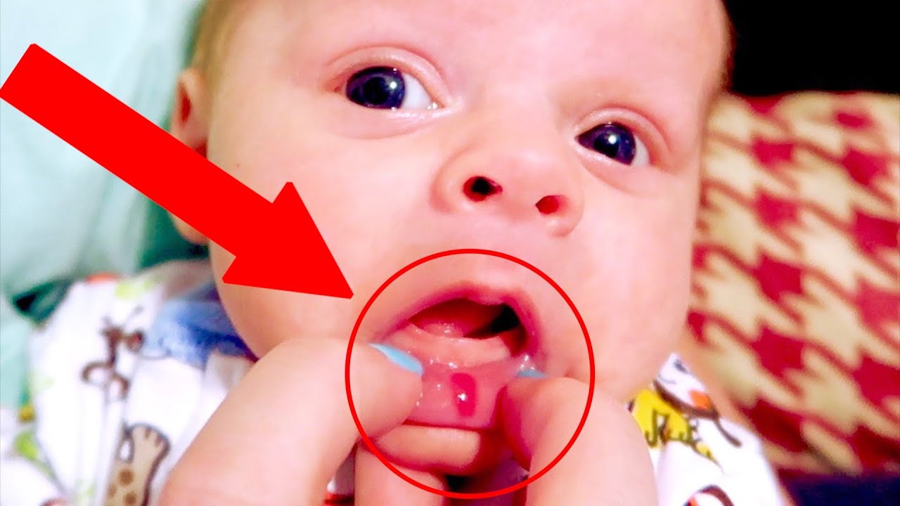 WHAT'S GROWING ON YOUR LIP?! - YouTube