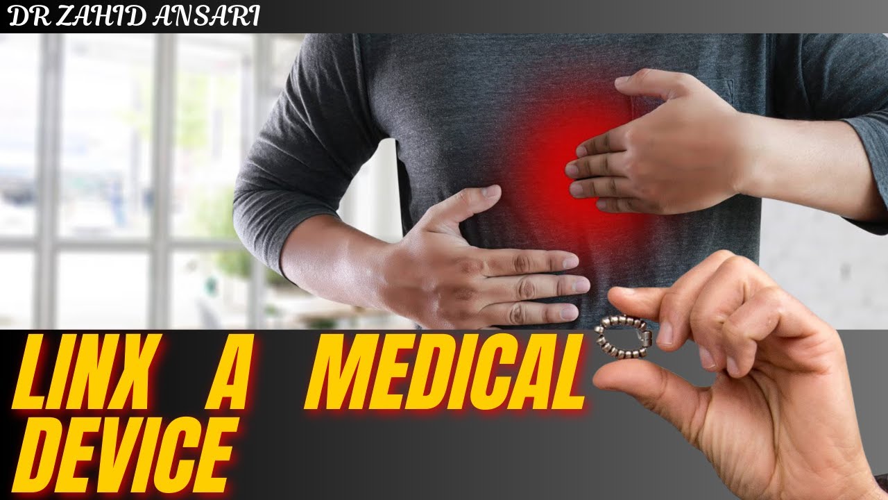 Linx A medical device #medical #science - YouTube