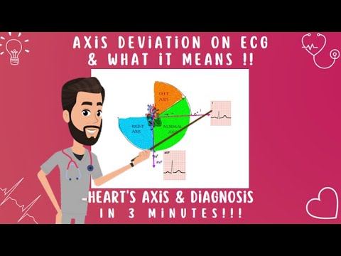 Axis Deviation on ECG: Diagnosis, Causes - 3 minute Medical Concept ...