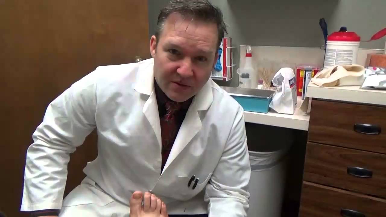 Post Op Arthroscopic Ankle Surgery with HyProCure Subtalar Joint Stent ...