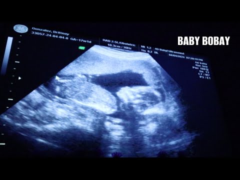 SEEING BABY BOBAY | Ultrasound Visit | - YouTube