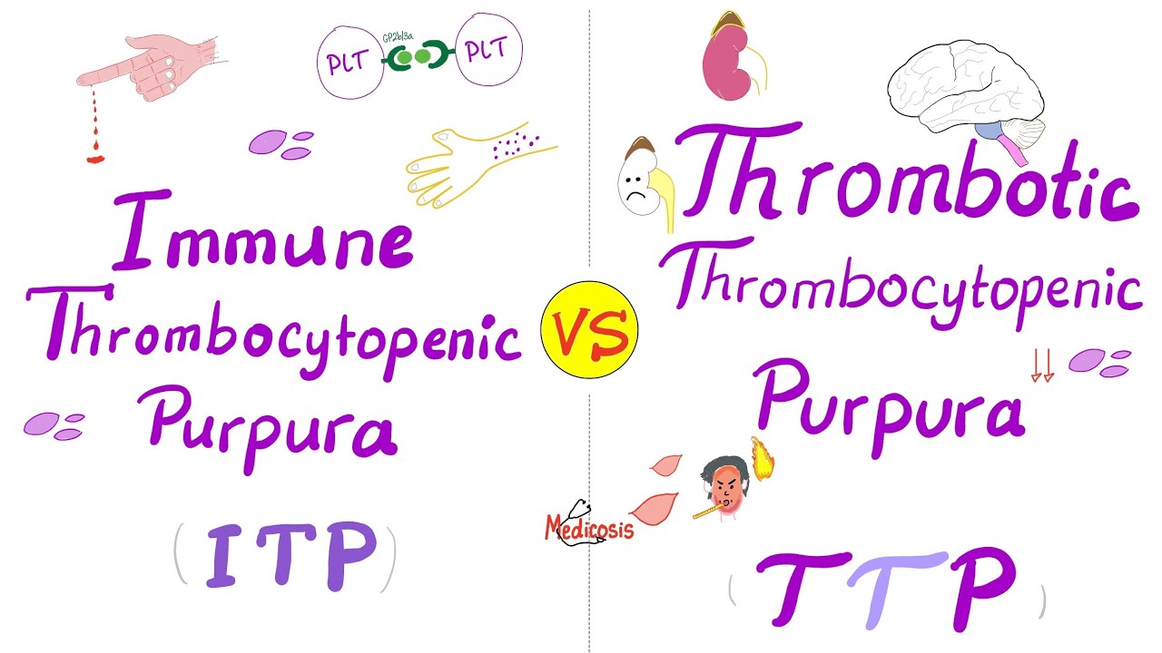 ITP vs TTP (Immune Thrombocytopenic purpura vs Thrombotic ...