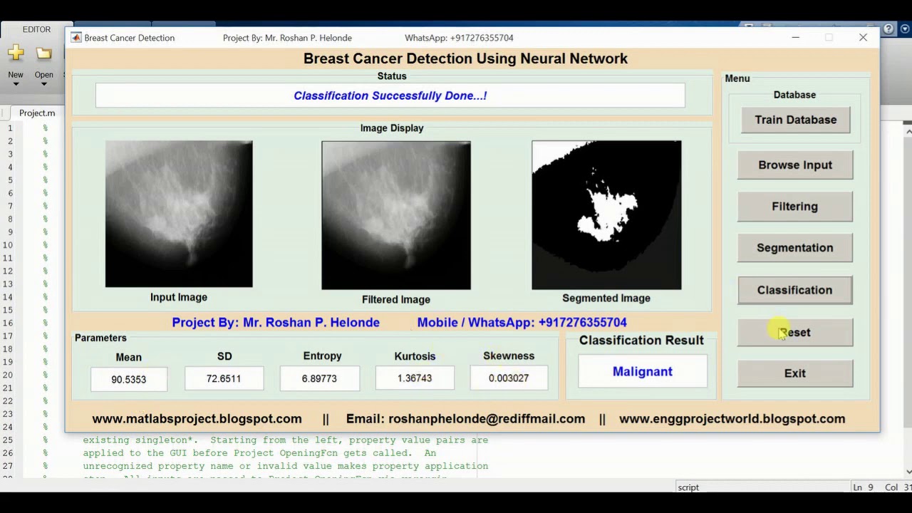 Matlab Project Breast Cancer Detection Using Image Processing Breast Cancer Detection Using