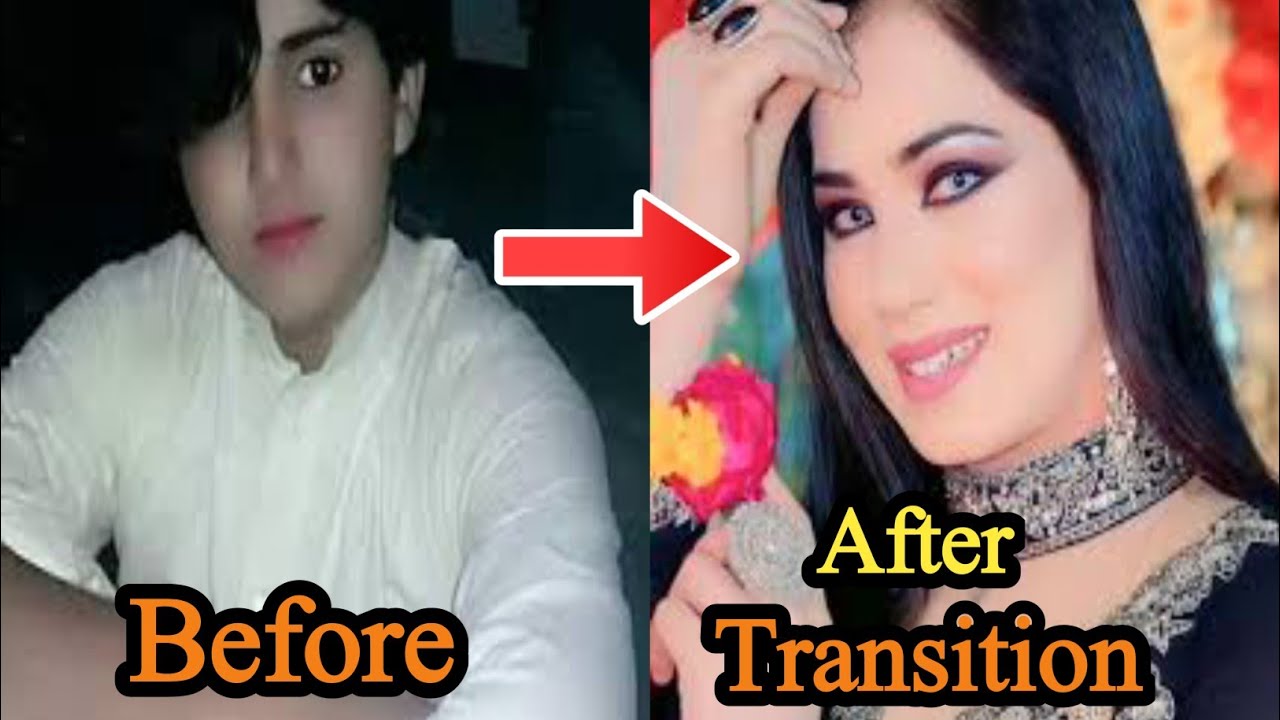 Male To Female Transition Timeline 2024 || Beautiful Trans Women Before ...