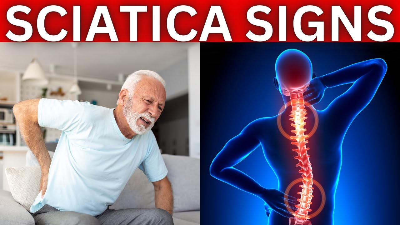 8 Key Signs of Sciatica You Should Never Ignore, Recognize the Symptoms ...