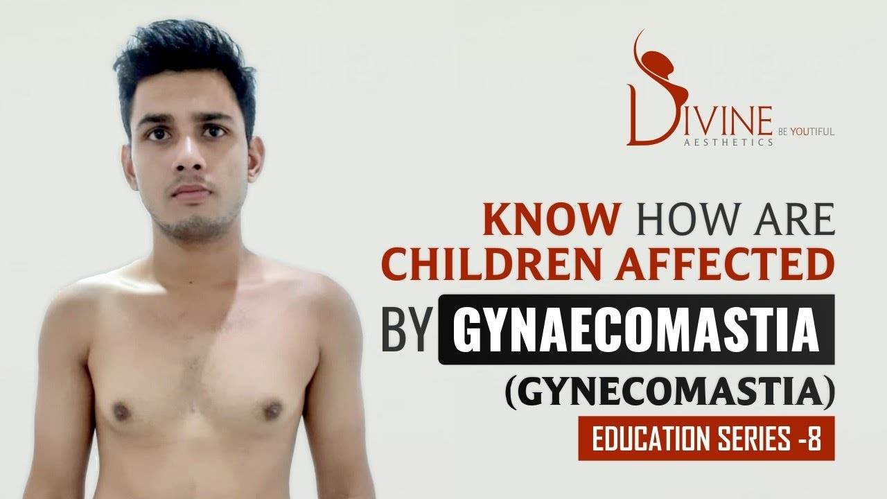 Does Children Affected by Gynaecomastia- (Education Series - Session 8 ...