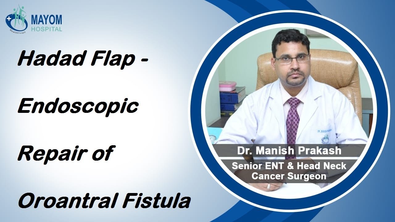 Hadad Flap - Endoscopic Repair of Oroantral Fistula - YouTube