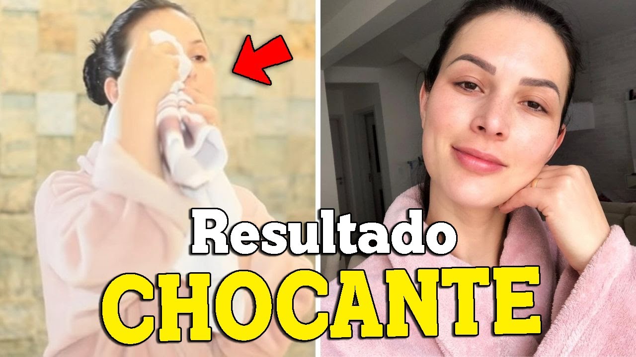ACORDOU com o ROSTO INCHADO? Saiba o que fazer! por Julia Doorman - YouTube