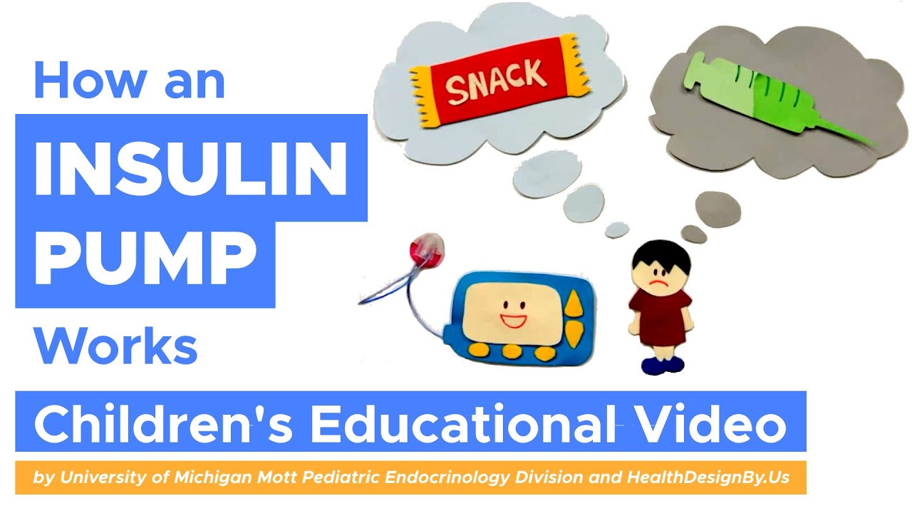 What is an Insulin Pump and How it works to help you take care of your ...