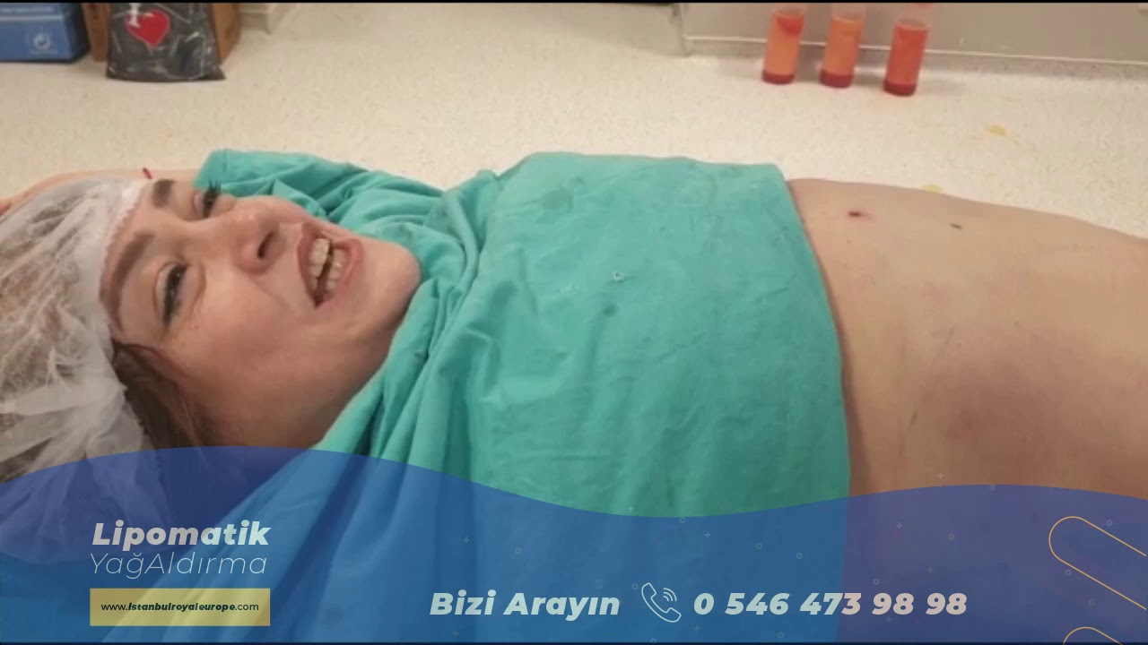 Lipomatik | Liposuction | Yağ Aldırma - YouTube