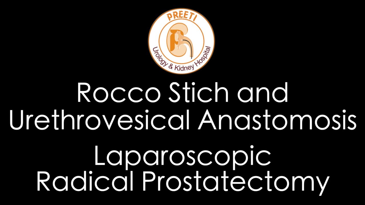 How to do Laparoscopic Rocco Stich and Urethrvesical Anastomosis - YouTube