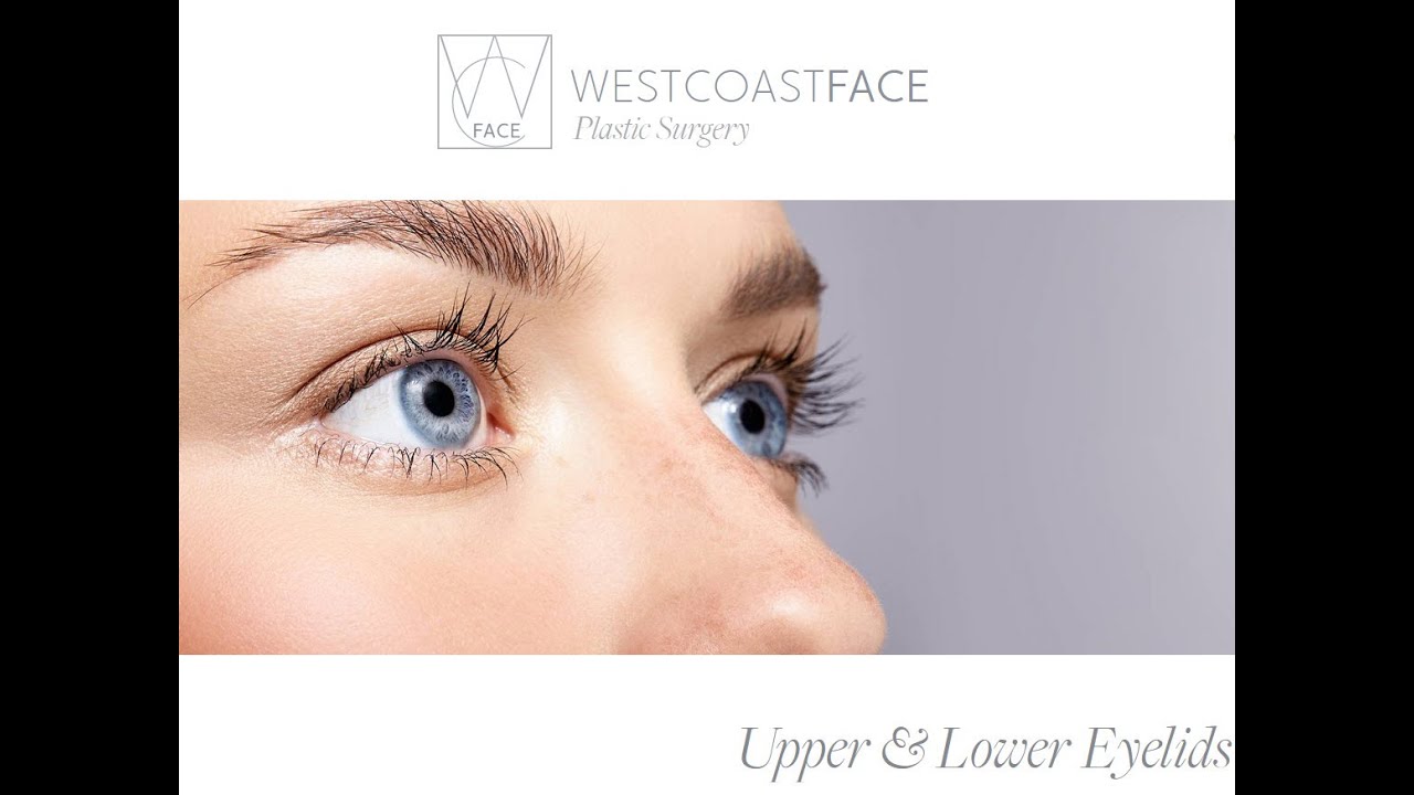 Blepharoplasty Eyelid Surgery in Seattle WA | Joseph Shvidler, MD - YouTube