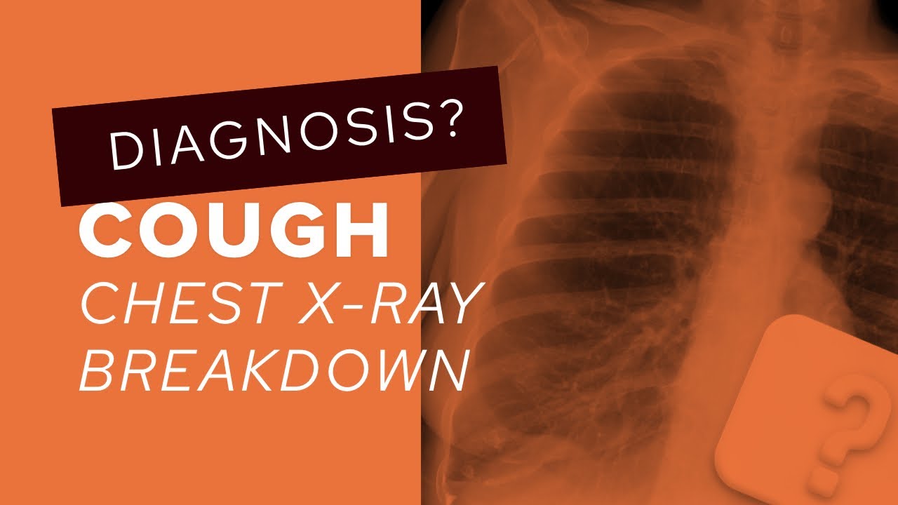 Chest X-Ray breakdown: clearing the retrocardiac region - YouTube