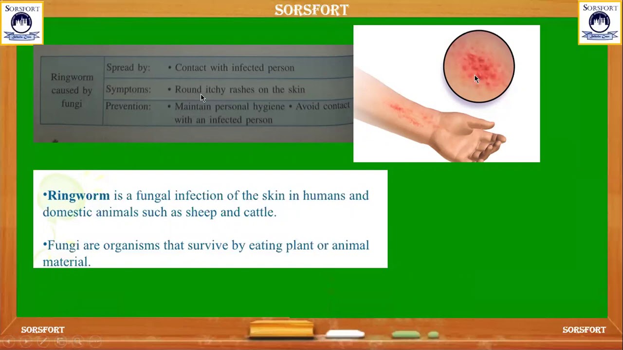 DISEASES// GRADE -5 // CH-2 FOOD, HEALTH AND DISEASES // PART-2 - YouTube