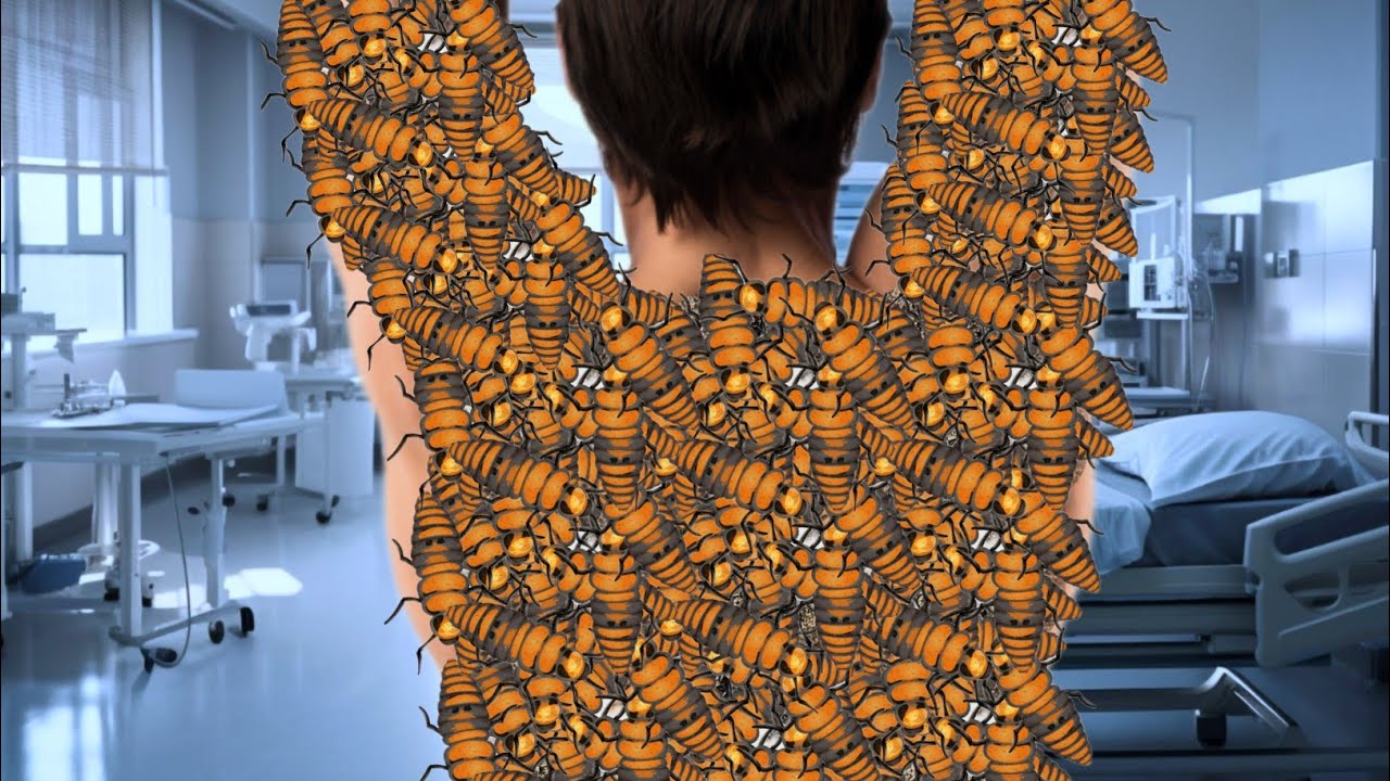 ASMR removal trypophobia & dog tick infected back said and body | ASMR ...