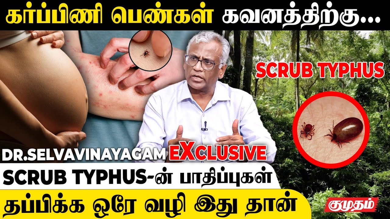 மீண்டும் சீனாவில் உருவெடுக்கும் வைரஸ்? - Dr.Selvavinayagam | China ...