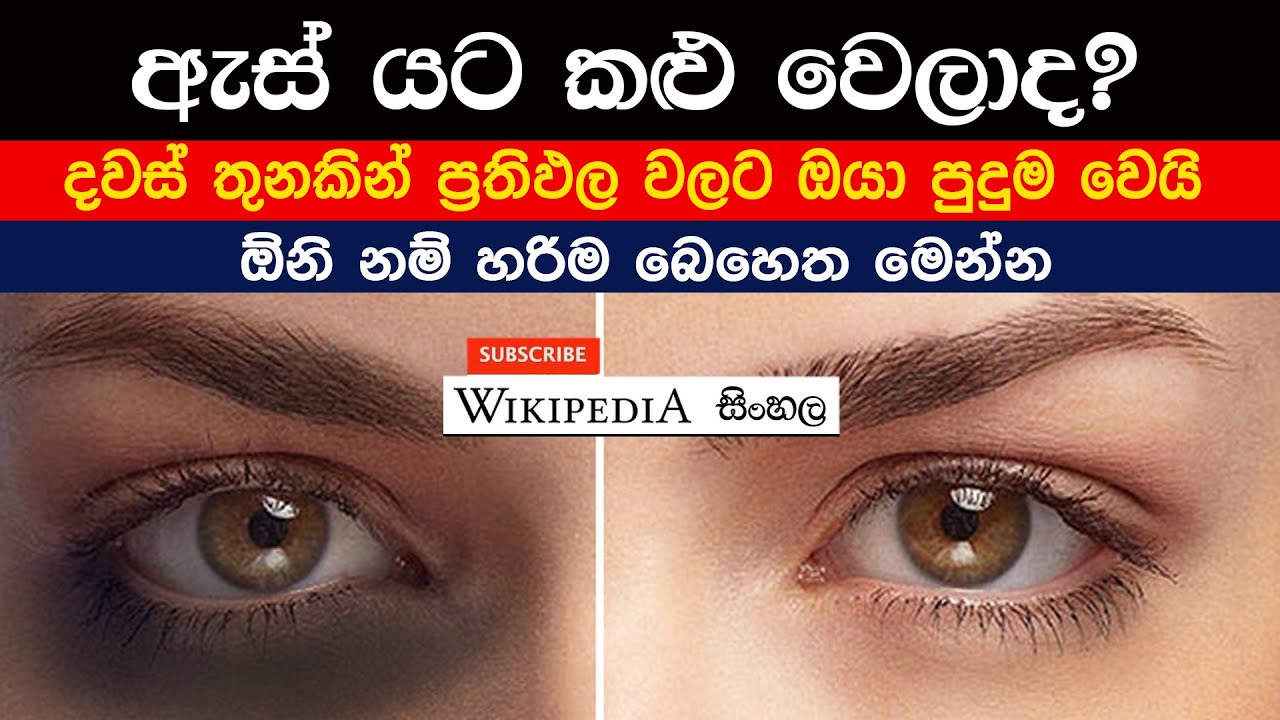 Dark Circles Sinhala | Remove Eyes bags | ඇස් යට කළුවීම් දවස් තුනෙන් ...
